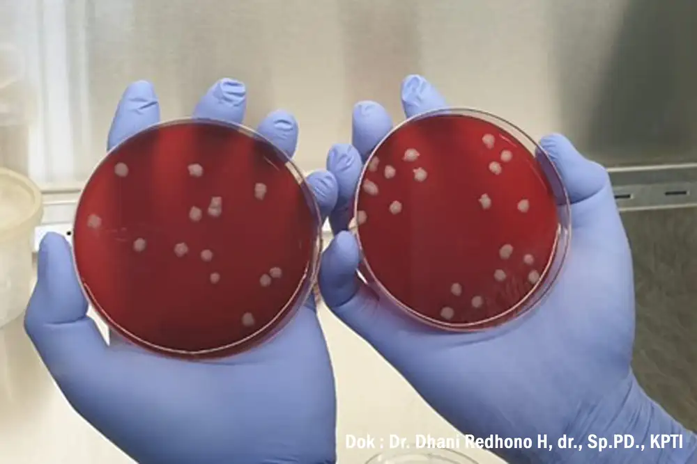 Medical Faculty of Sebelas Maret University | Anthrax, a Rare but ...